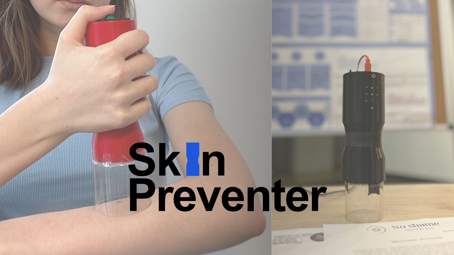 Skin Preventer